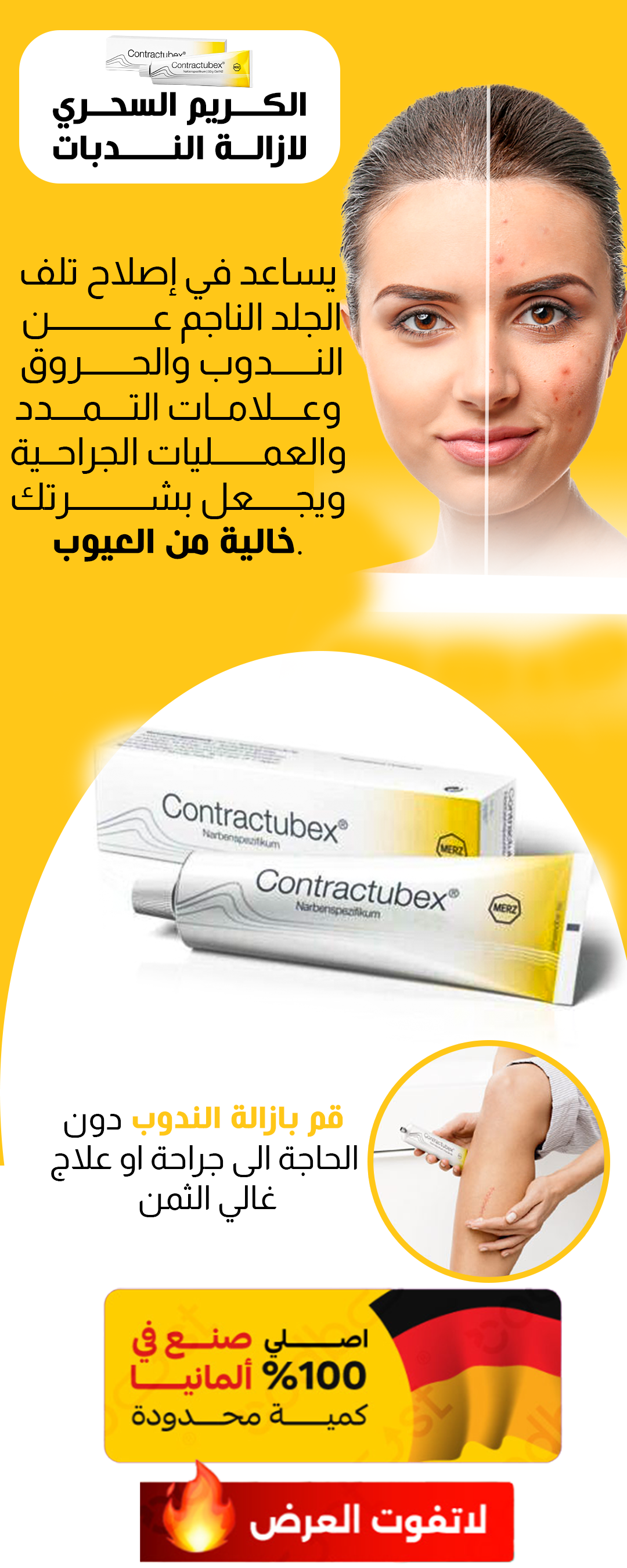 contractubex gel 20 mg – ammsud